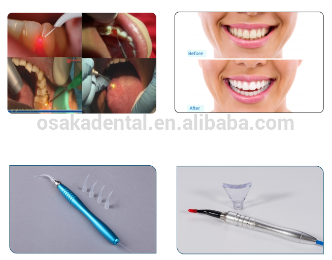 Medical Diode Laser Systems